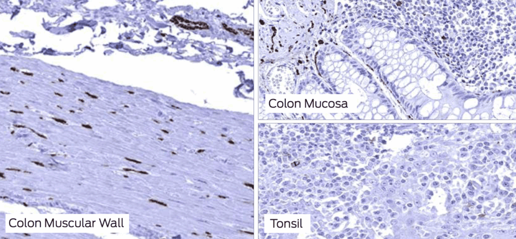 Control Slides, IHC, CD 56, Box of 100 | Mopec