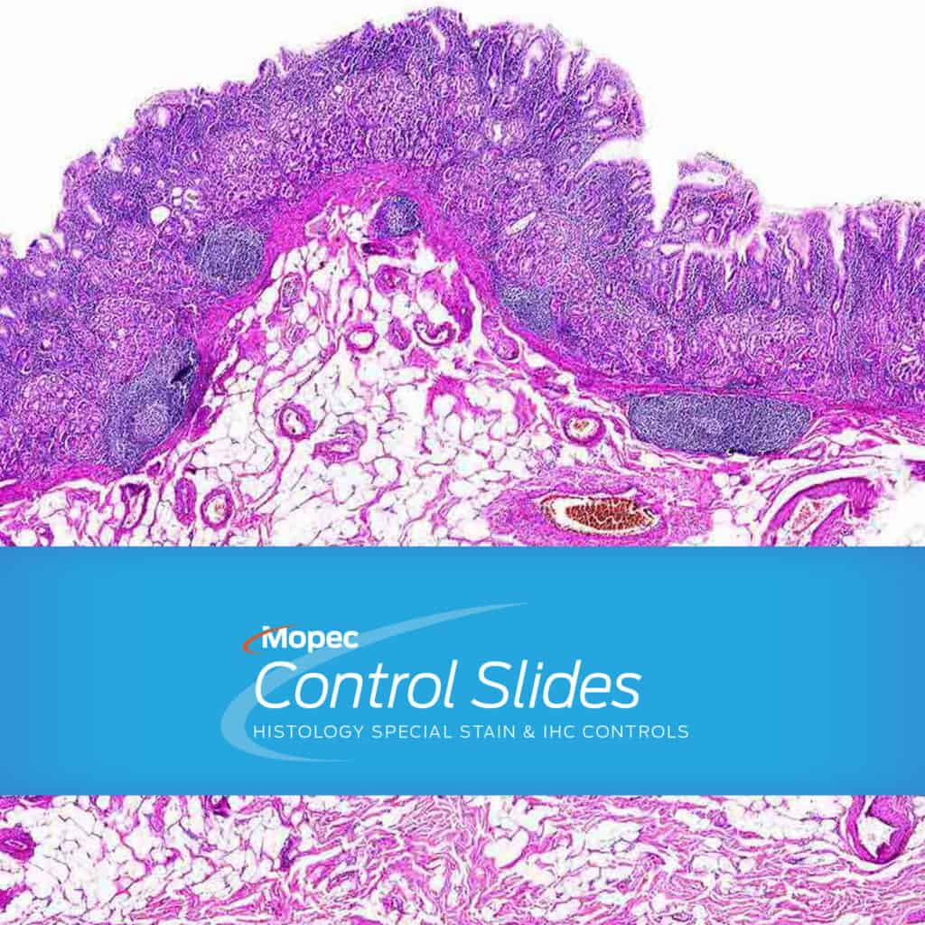 Anatomic Pathology Consumables | Mopec
