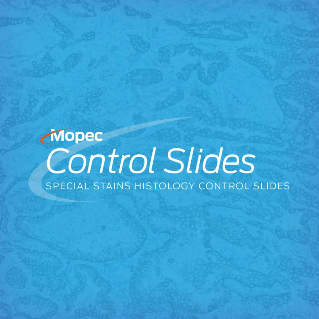 Control Slides, Special Stains, Iron (ferric) remarkable in ...