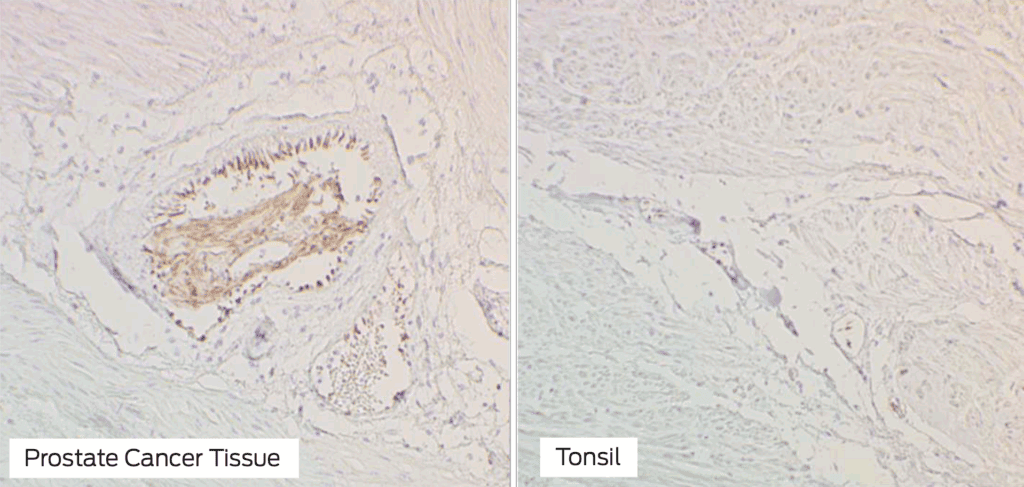 Control Slides, IHC, ERG, Box of 25 | Mopec