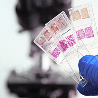 Control Slides | Mopec