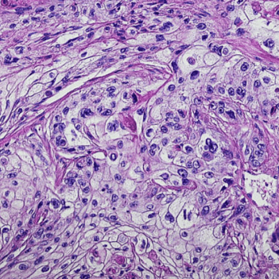 Control Slides | Mopec