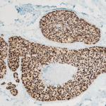 Control Slides | Mopec