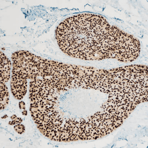 Control Slides | Mopec