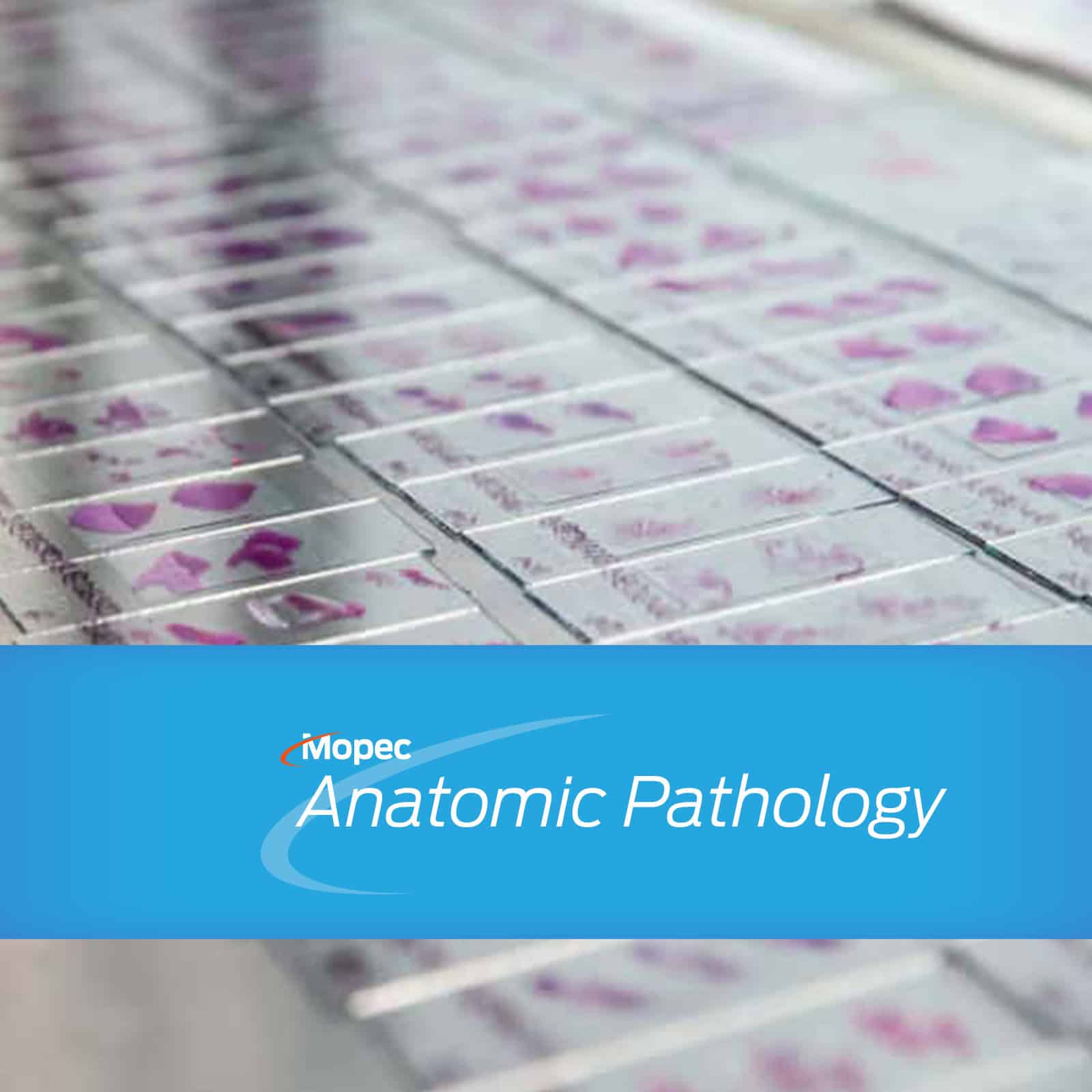 Anatomic Pathology Consumables Mopec