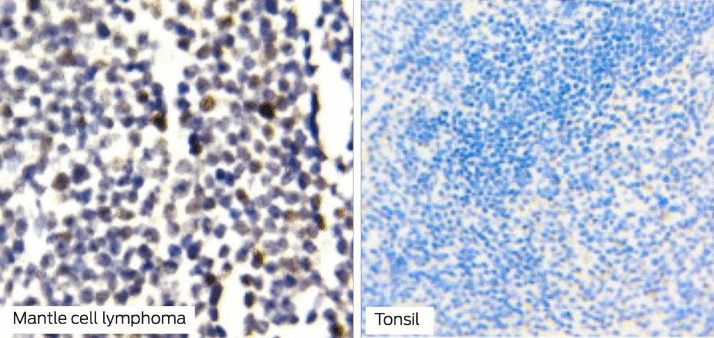 Control Slides, IHC, SOX11, Box of 100 | Mopec